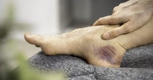 Common Dance Injuries and How To Prevent Them | Stagestep