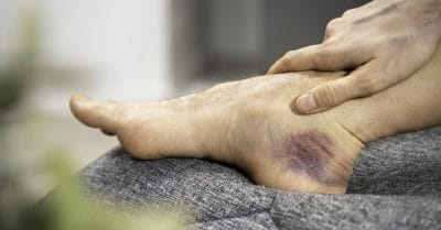 Common Dance Injuries and How To Prevent Them | Stagestep